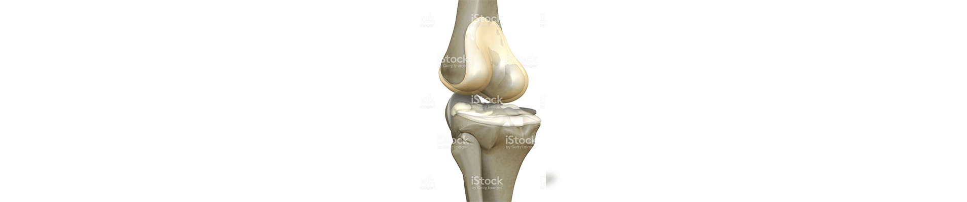 Knee replacement Medical 3D Animation | Motion Graphics Video ...