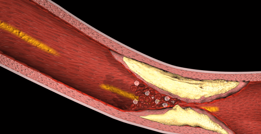 Work Samples | Medical Animation Videos - Medical 3D Animation Company ...