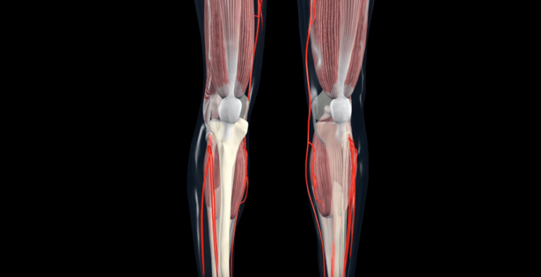 Leg Bone Trabecula Cancellous Trabecular Spongy 3D Animation - Medical ...